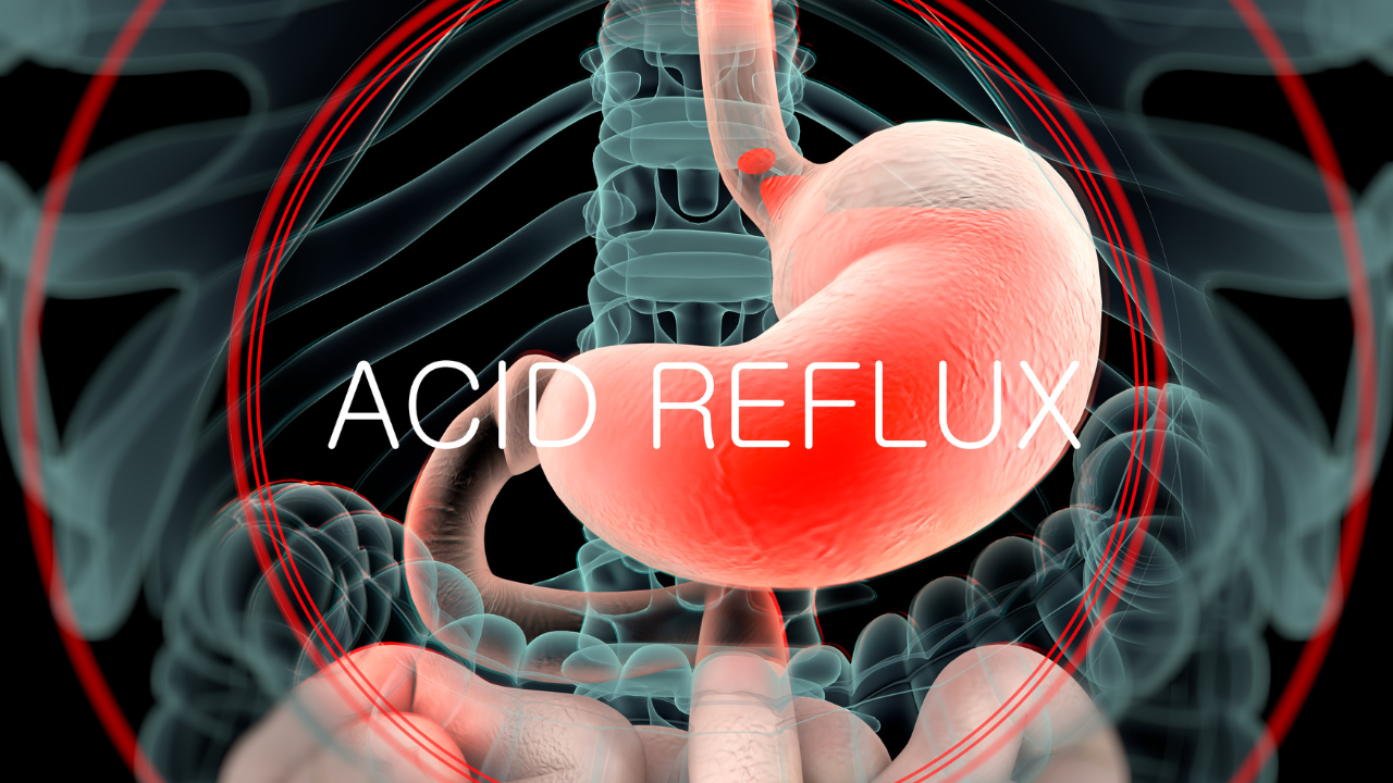 Metabolic Balance | » Trápí vás reflux? Principy Metabolic Balance ...